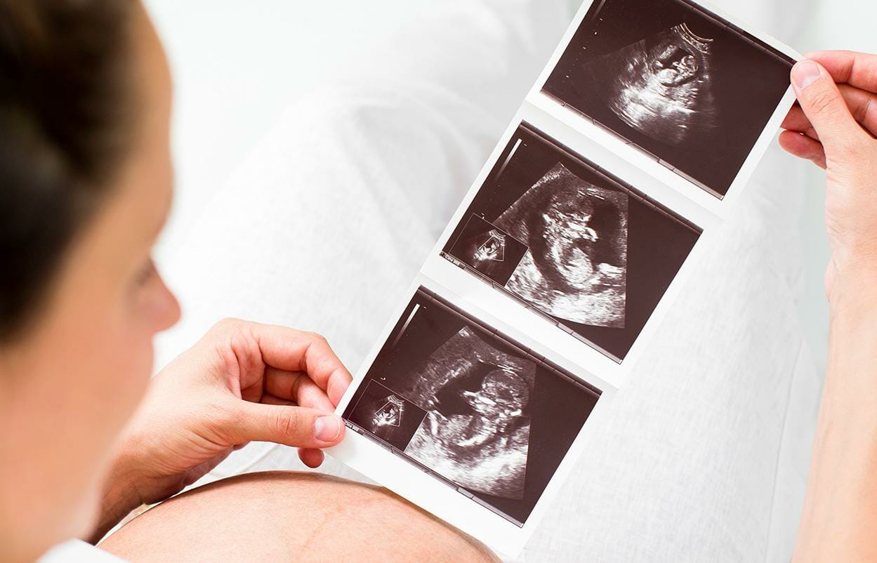 3 JENIS ALAT USG BESERTA KEGUNAANNYA | Syaf Unica Indonesia