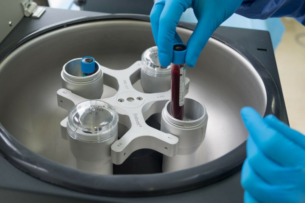 KARAKTERISTIK CENTRIFUGE TUBE BESERTA JENIS-JENISNYA | Syaf Unica Indonesia