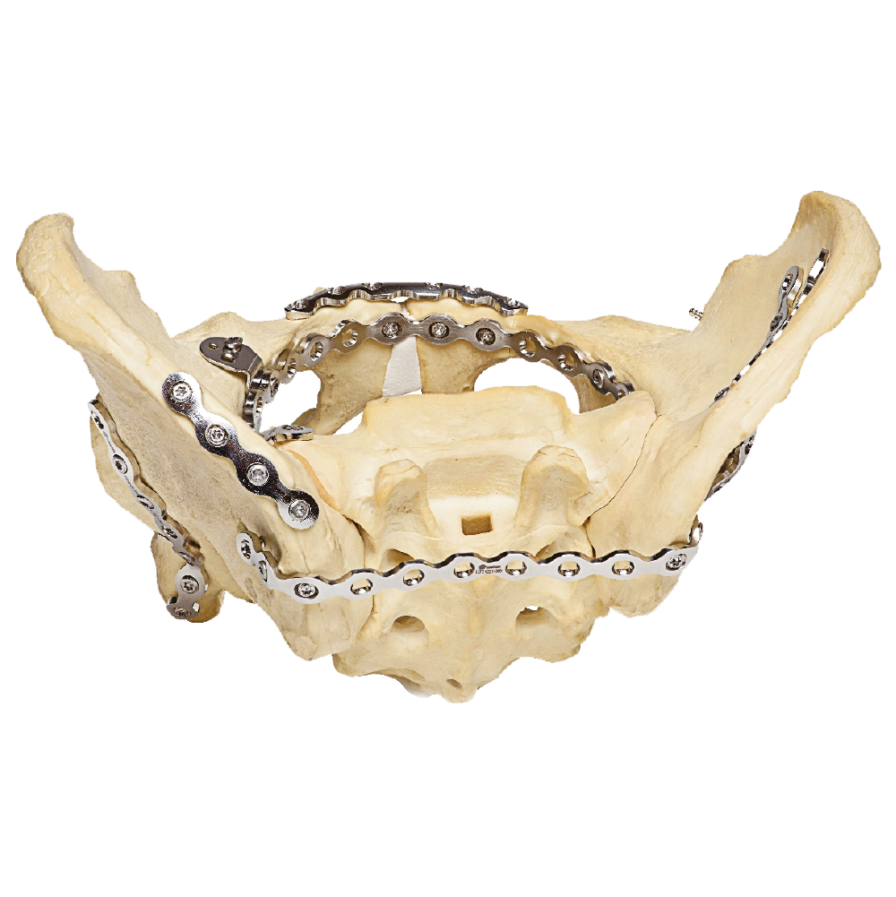 BONE PLATE - ROUNDED PELVIC RECONSTRUCTION PLATE - 6, 7, 8, 9, 10 HOLES ...